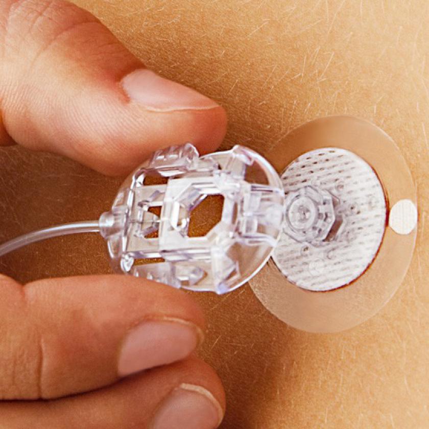 Infusionsset Cleo 90-Subkutan 6 mm/80 cm 10 Stück